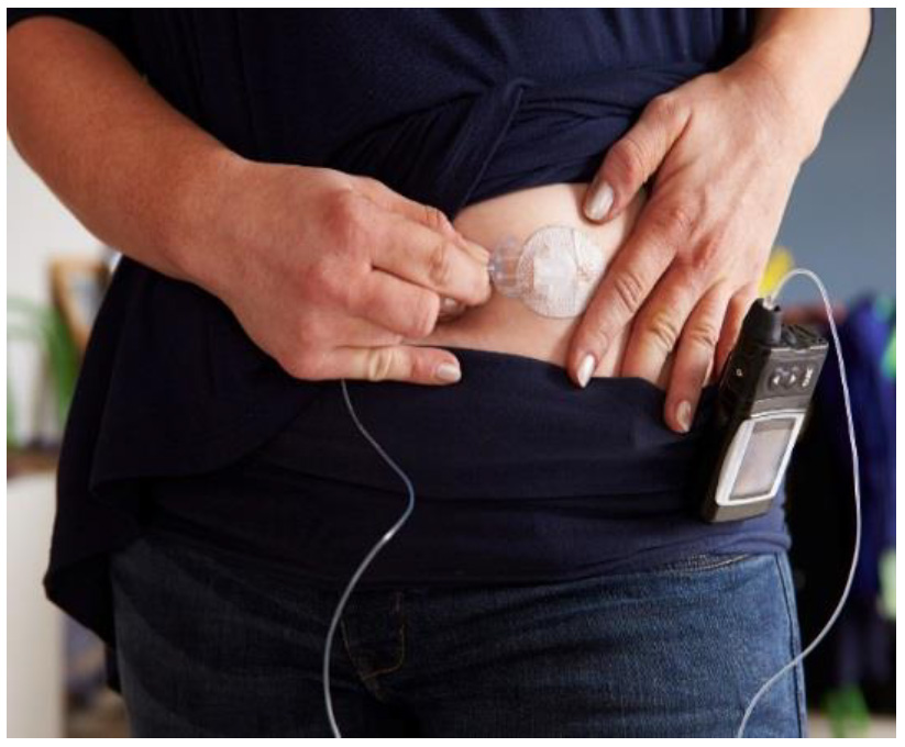 DowDuPont Specialty Products Division Launches New Soft Skin Adhesive ...
